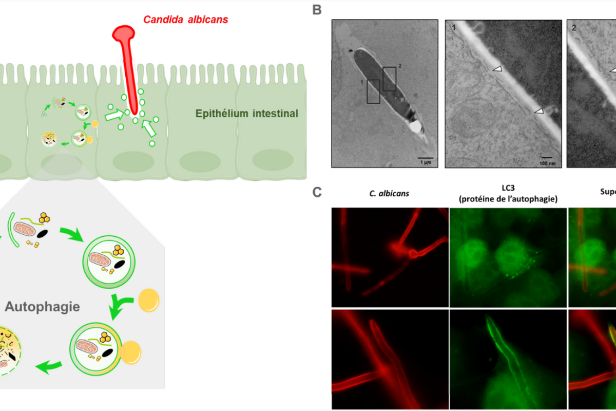 Membrane protective role of autophagic machinery during infection of ...
